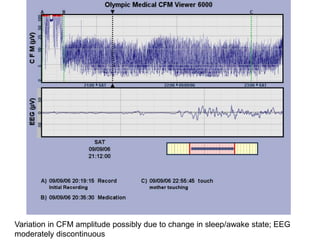 Olympic CFM cases.ppt