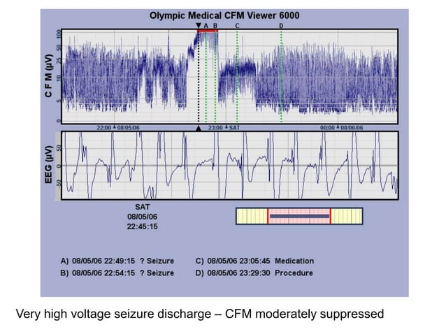 Olympic CFM cases.ppt