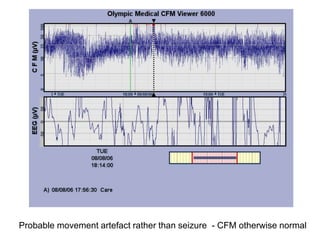 Olympic CFM cases.ppt