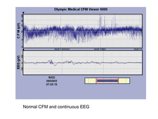 Olympic CFM cases.ppt