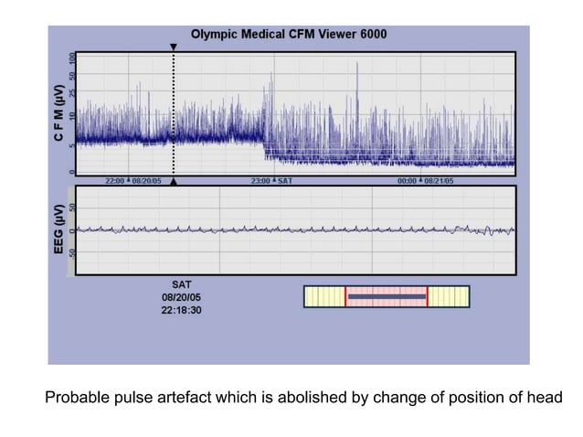 Olympic CFM cases.ppt