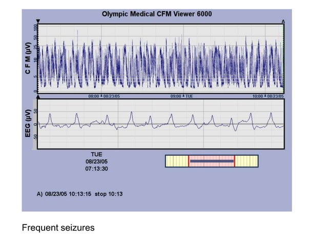 Olympic CFM cases.ppt