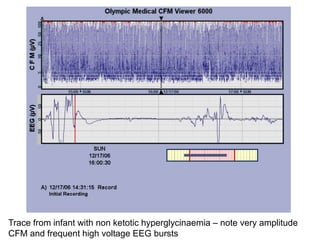 Olympic CFM cases.ppt