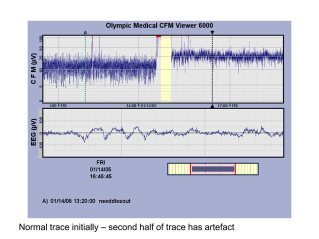 Olympic CFM cases.ppt