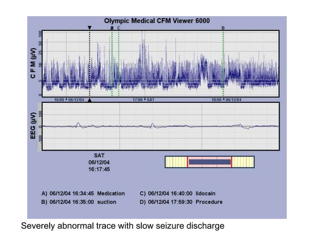 Olympic CFM cases.ppt