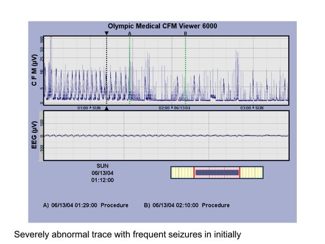 Olympic CFM cases.ppt