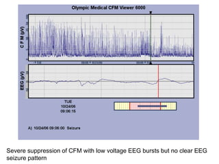 Olympic CFM cases.ppt