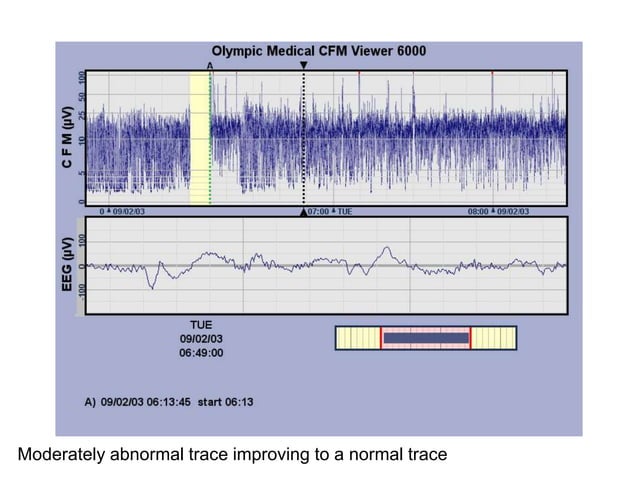 Olympic CFM cases.ppt