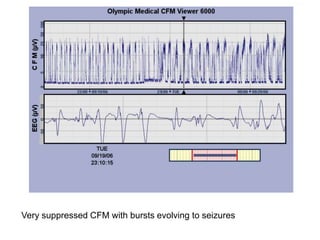Olympic CFM cases.ppt