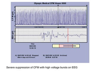 Olympic CFM cases.ppt
