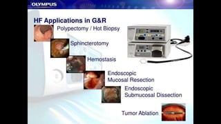 Olympus esg100 new dimension in electrosurgery | PPT | Free Download
