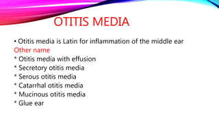 otitis media | PPT