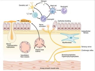 Omalizumab | PPT