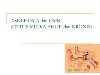 otitis media akut dan otitis media kronis | PPT