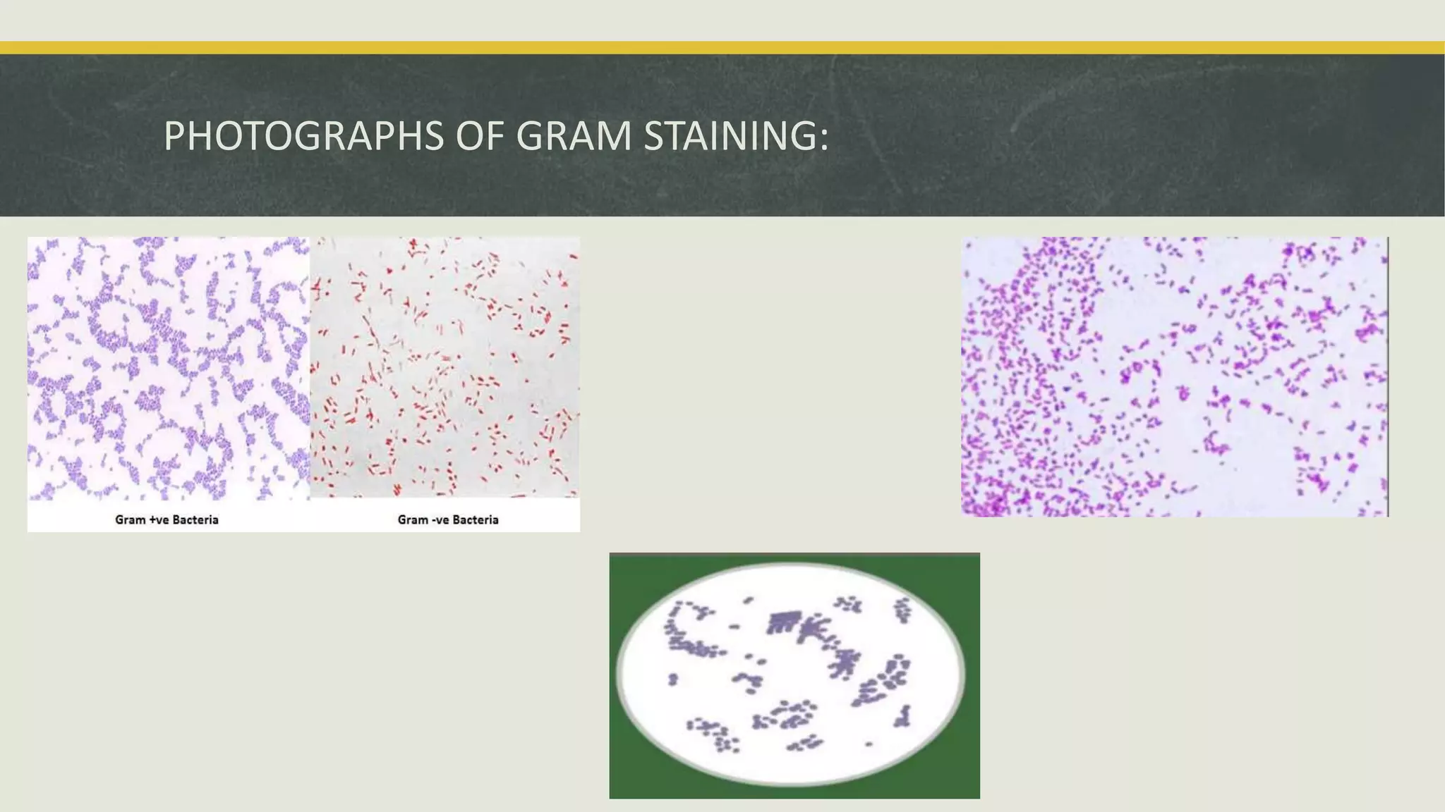 Omar Arar ( Gram's stain).pptx