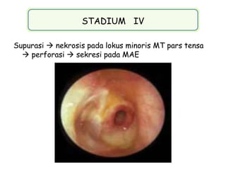 OMA menu-akan penyakit yang terjadi di telling tengah.pptx