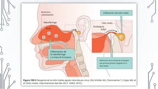 Otitis Media Aguda, diagnostico y tratamiento. | PDF