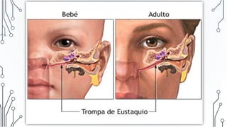 Otitis Media Aguda, diagnostico y tratamiento. | PDF