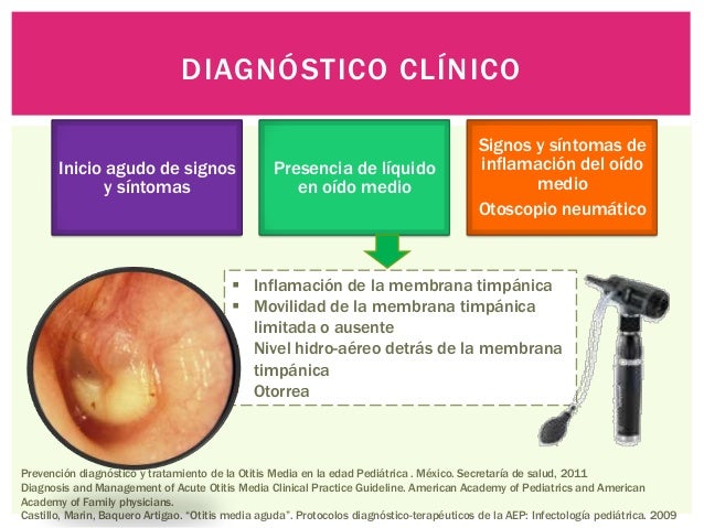 Otitis Media Y Otitis Externa: Síntomas, Causas Y Tratamiento – FRGIY