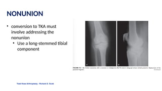 Conversion Of Osteotomy To Total Knee Arthroplasty (TKA) | PPTX