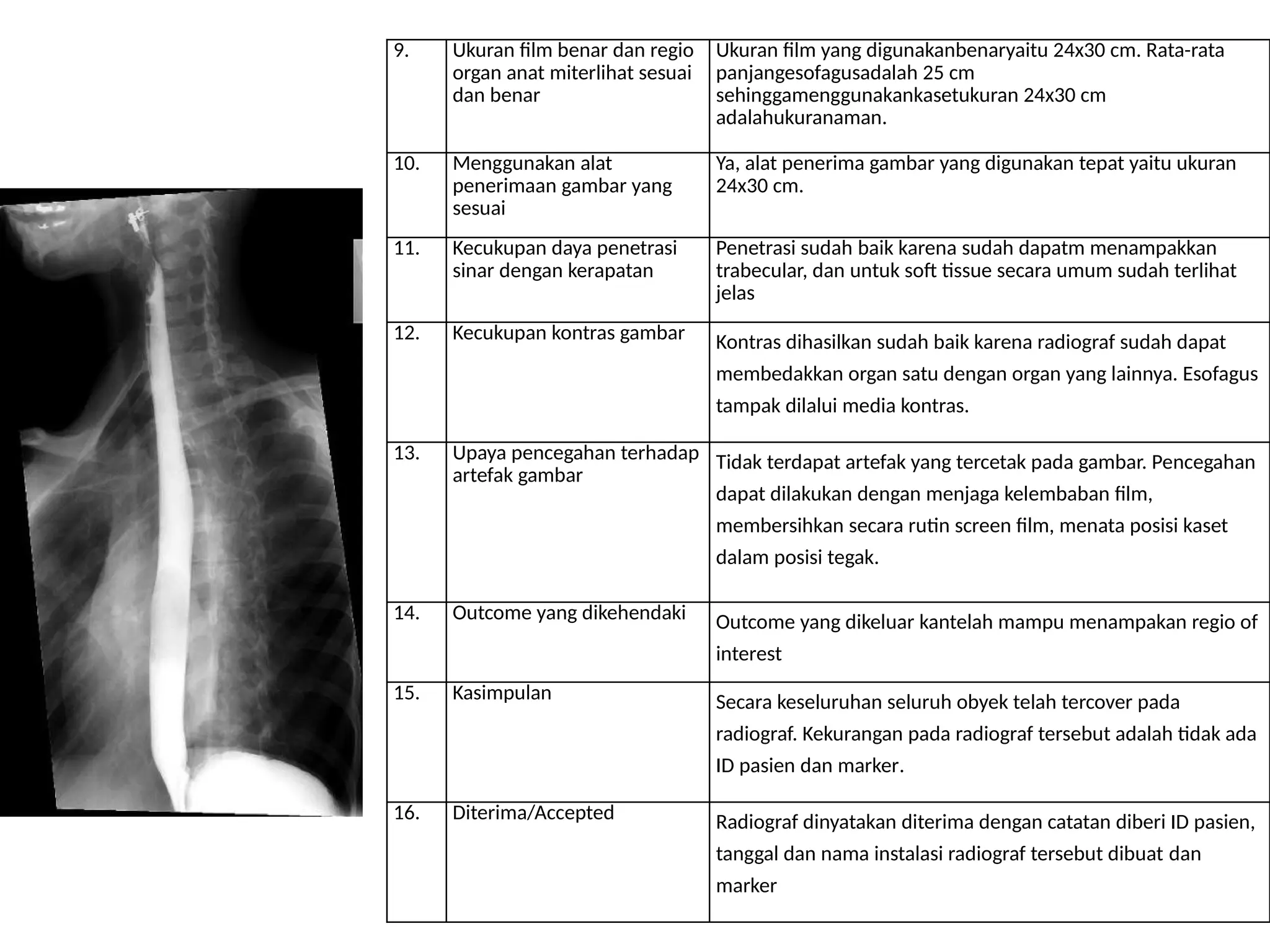 radiography examination of Osefagus Maag Duodenum | PPTX