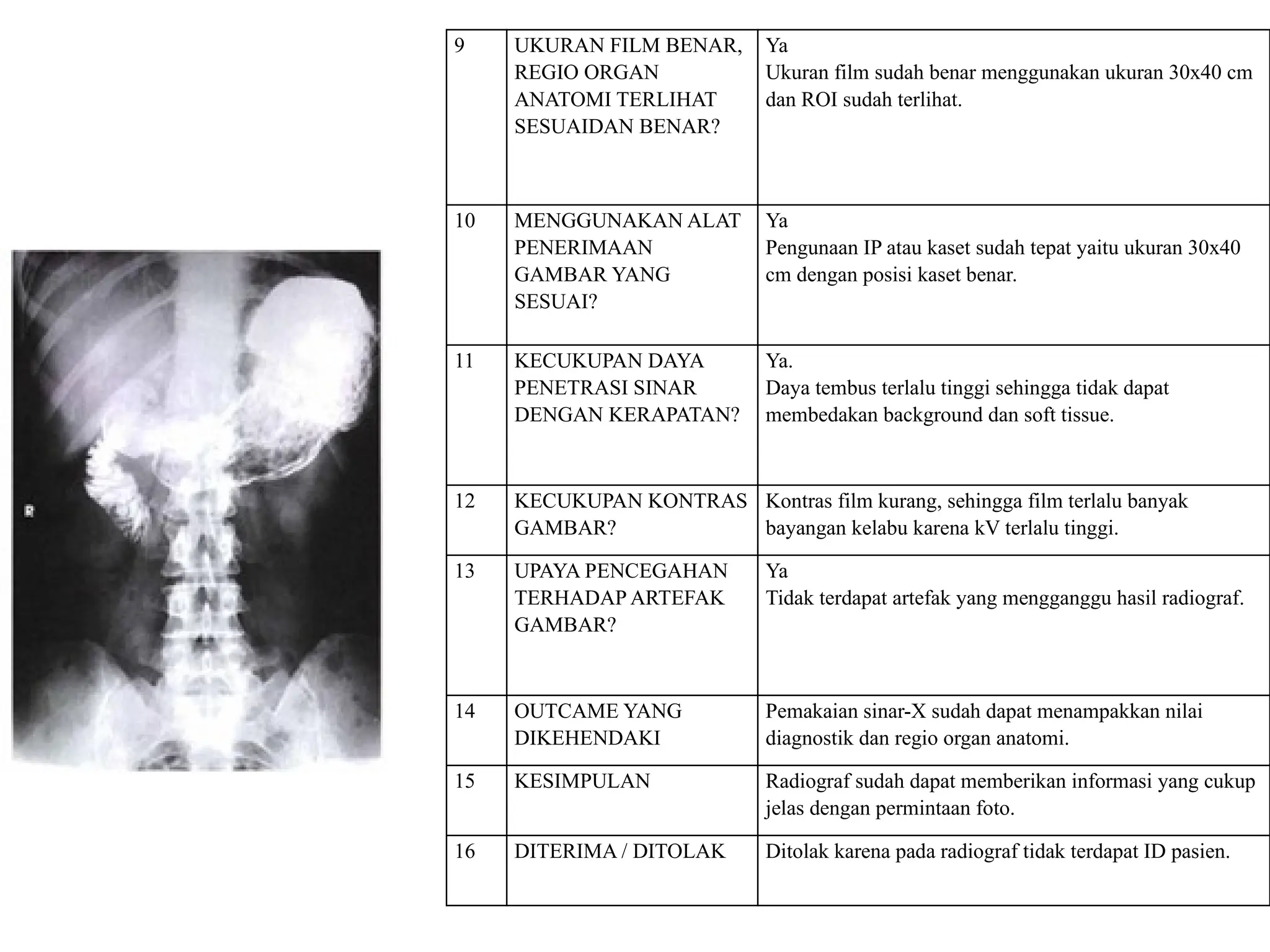 radiography examination of Osefagus Maag Duodenum | PPTX