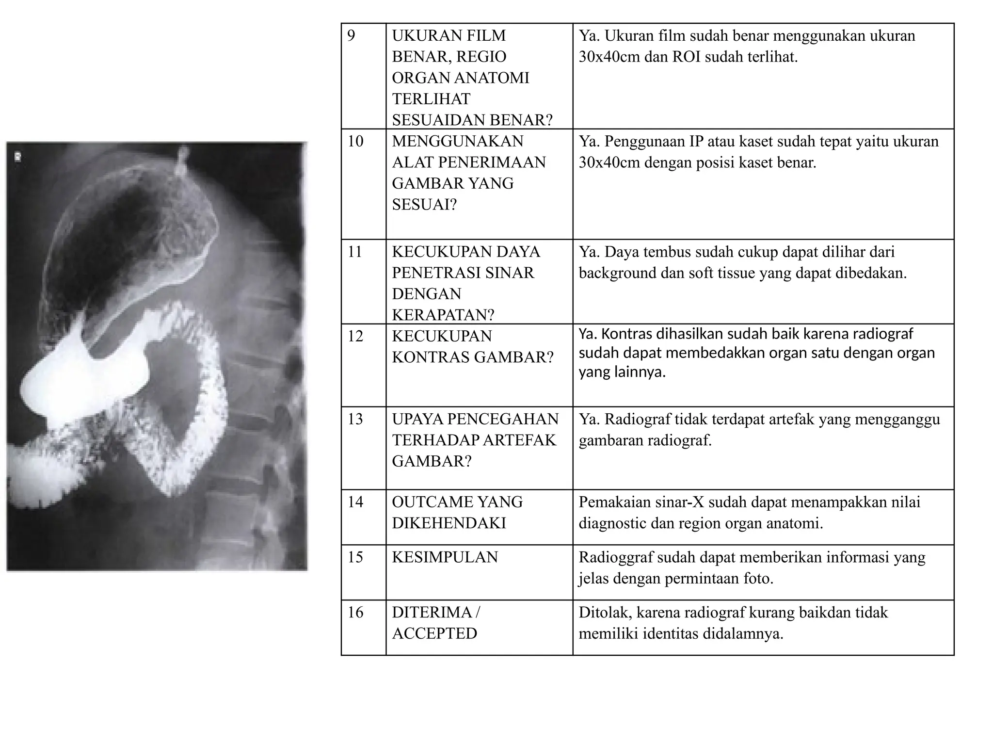 radiography examination of Osefagus Maag Duodenum | PPTX
