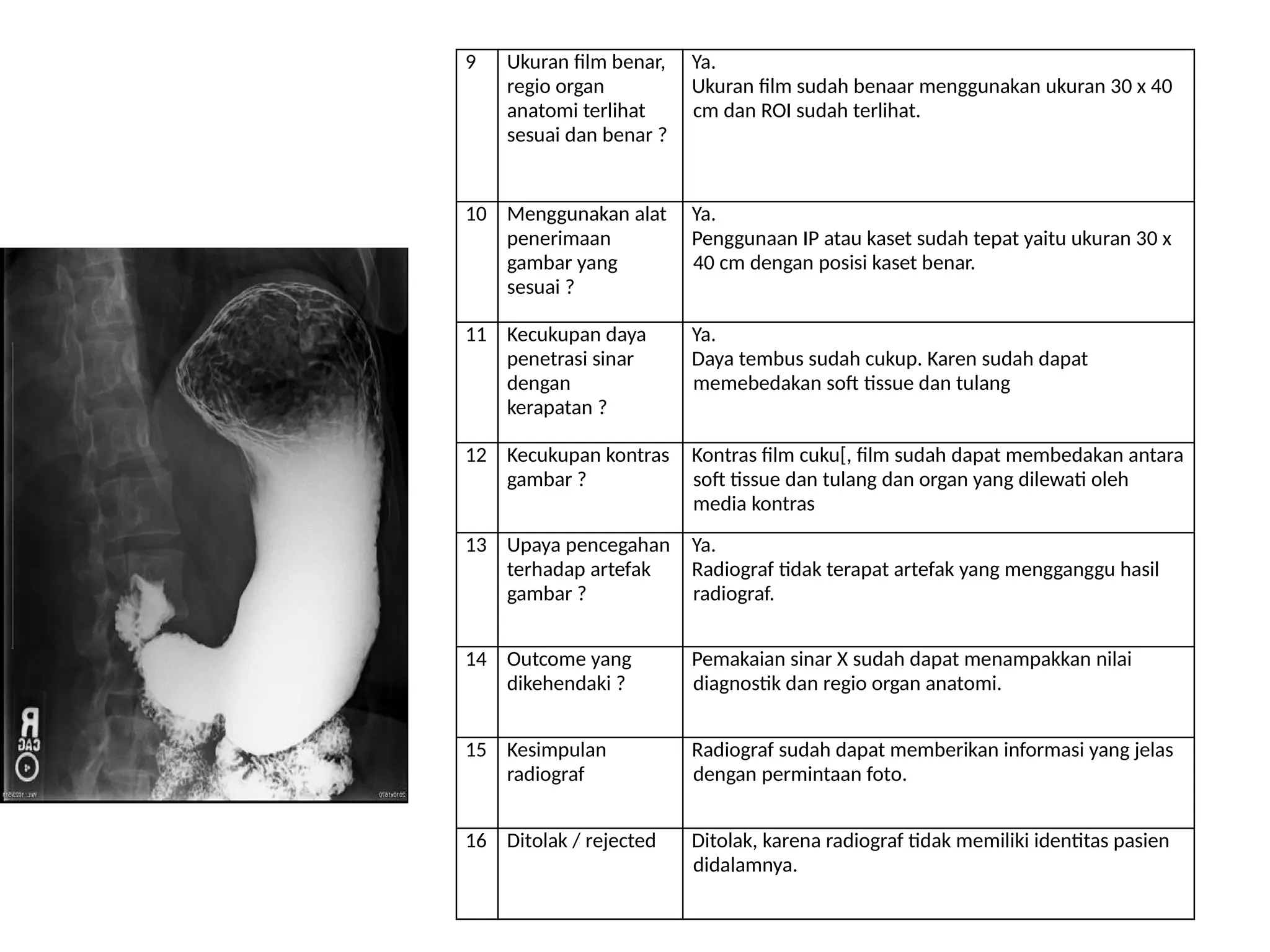 radiography examination of Osefagus Maag Duodenum | PPTX