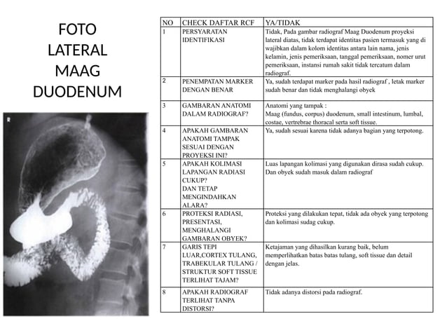 radiography examination of Osefagus Maag Duodenum | PPTX