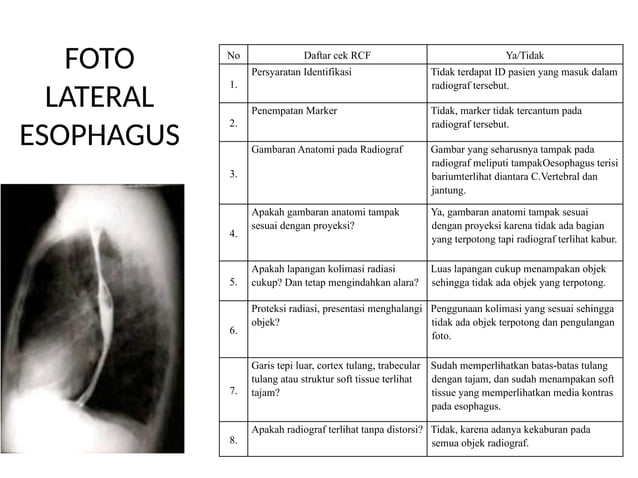 radiography examination of Osefagus Maag Duodenum | PPTX