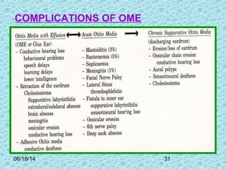 OME | PPT