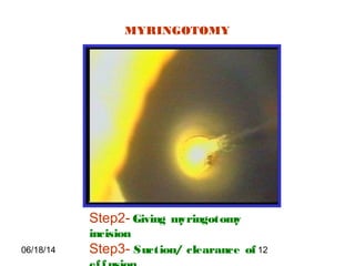 Ome case presentation | PPT