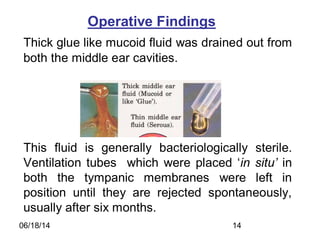 Ome case presentation | PPT