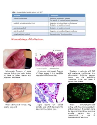 dental Management of Systemic Lupus Erythematous & Scleroderma | DOCX