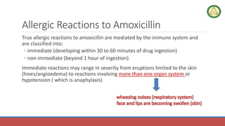 Dental Management of Anaphylaxis | PPTX
