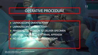 A rare case of Omental & Fibroid Torsion | PPTX