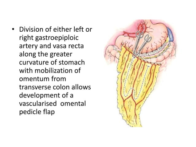 Omentum – anatomy, pathological conditions and surgical importance | PPTX