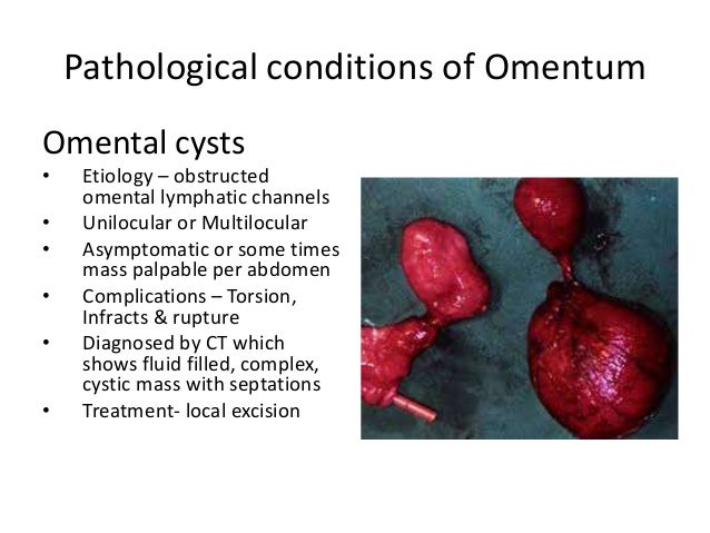 Omentum – anatomy, pathological conditions and surgical importance