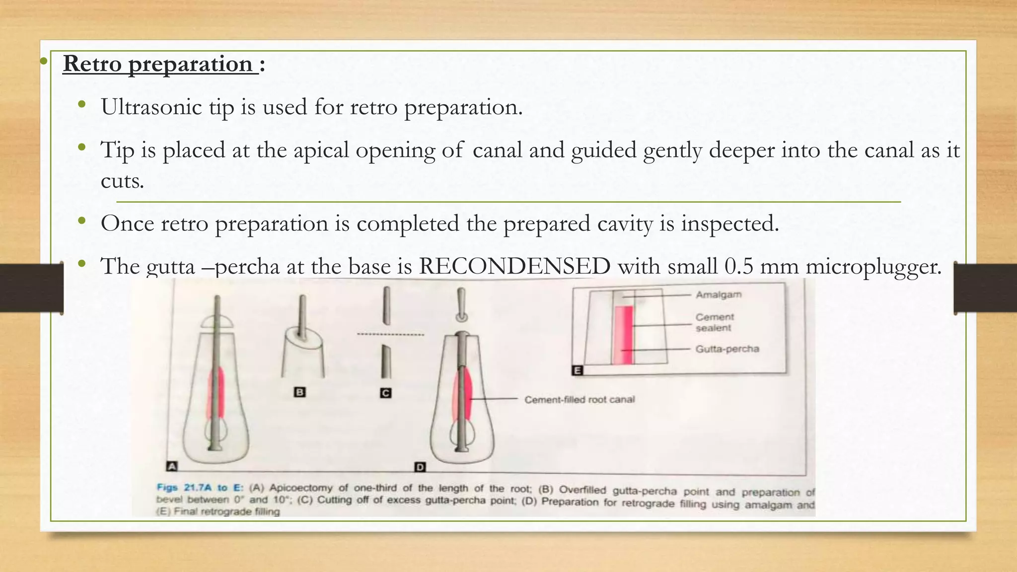 surgical endodontics | PPTX