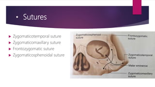 fractures of zygomatic bone | PPTX