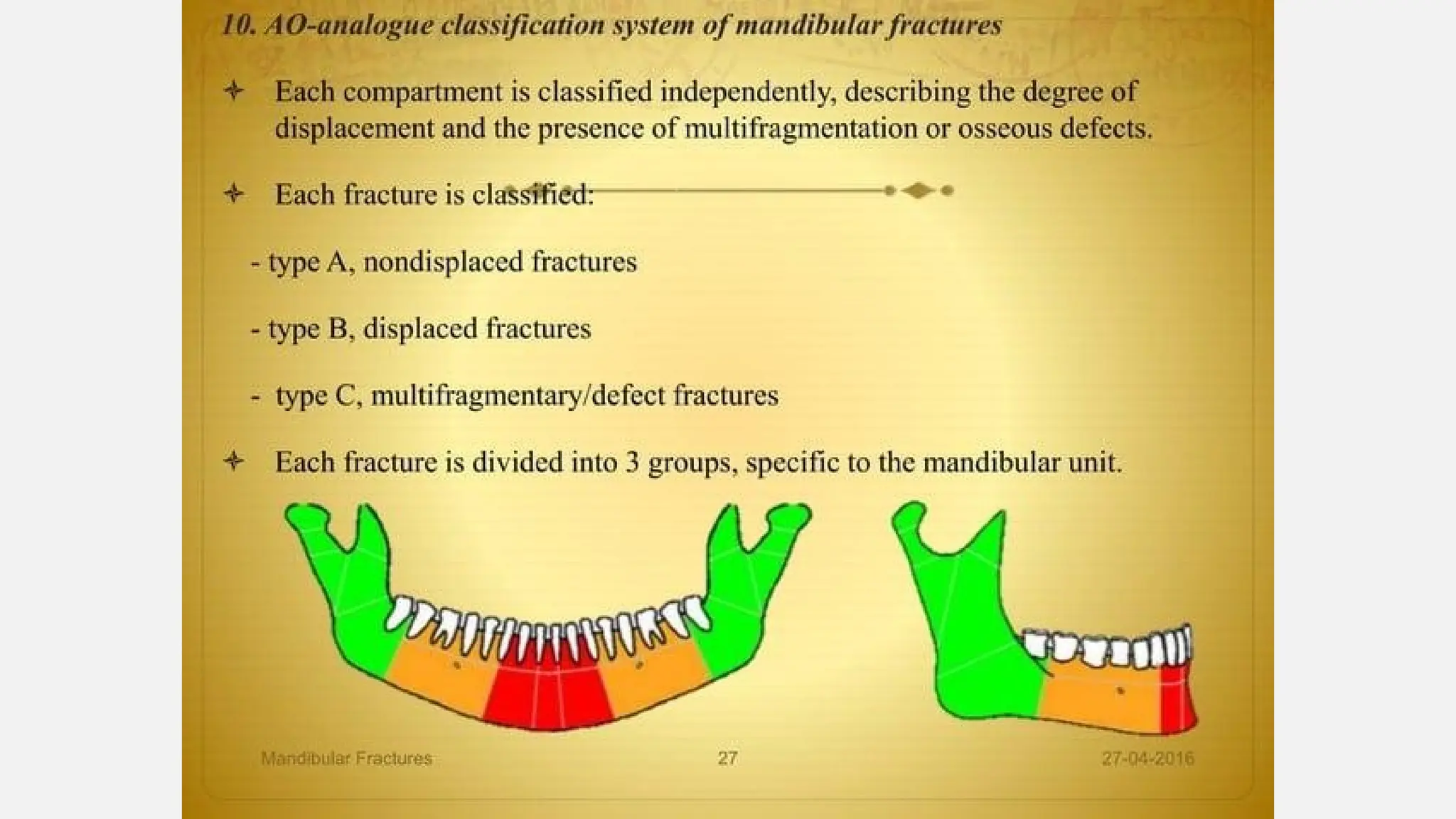 Classifications used in Oral and maxillofacial surgery.pptx