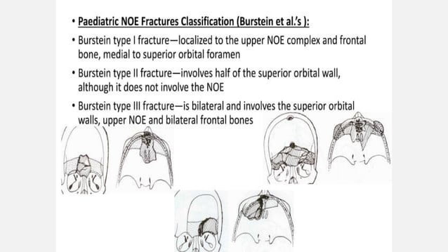 Classifications used in Oral and maxillofacial surgery.pptx