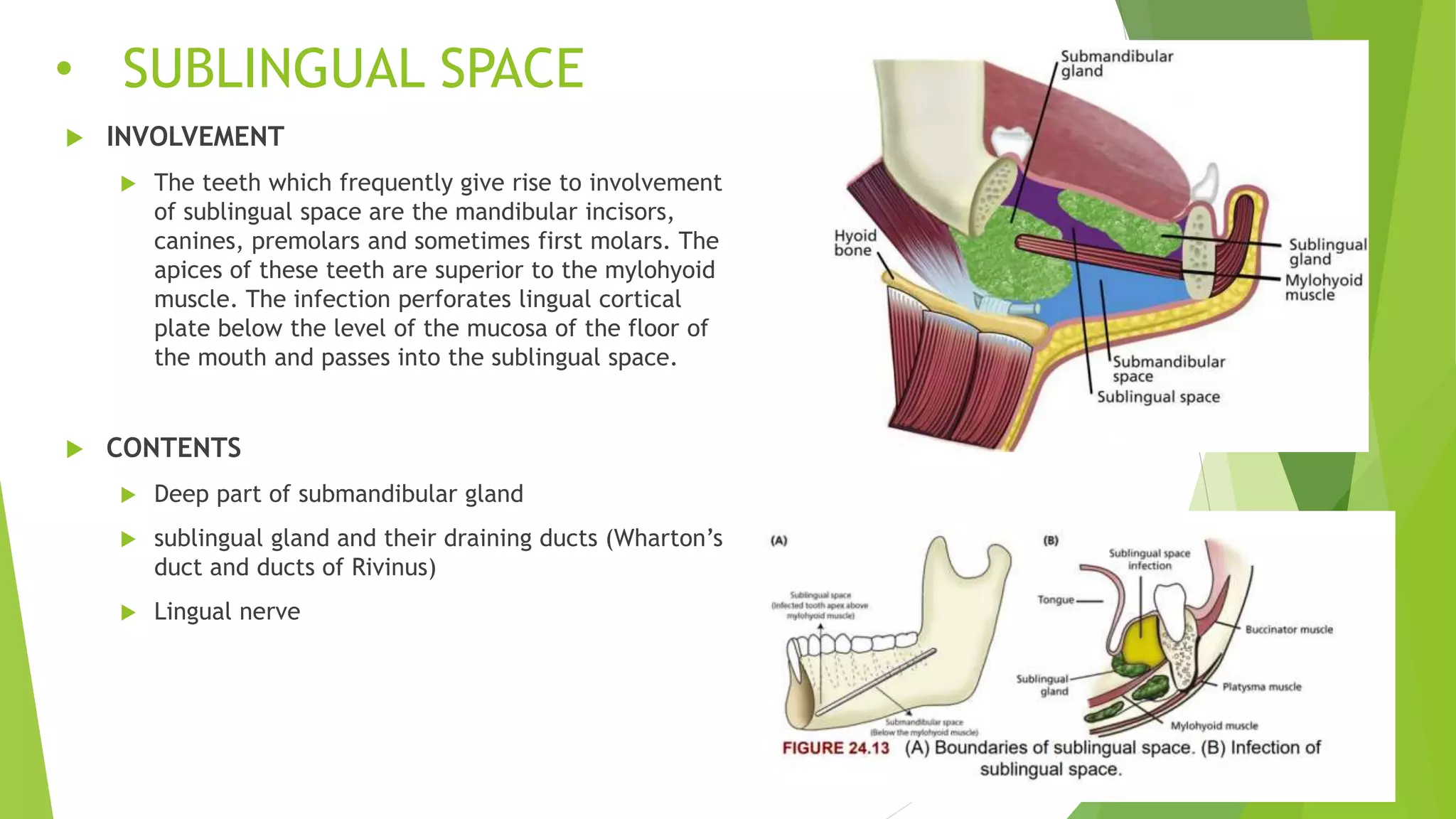 OMFS mandibular space infection.pptx