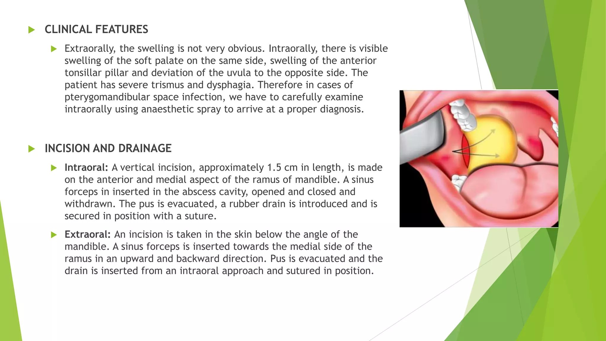 OMFS mandibular space infection.pptx