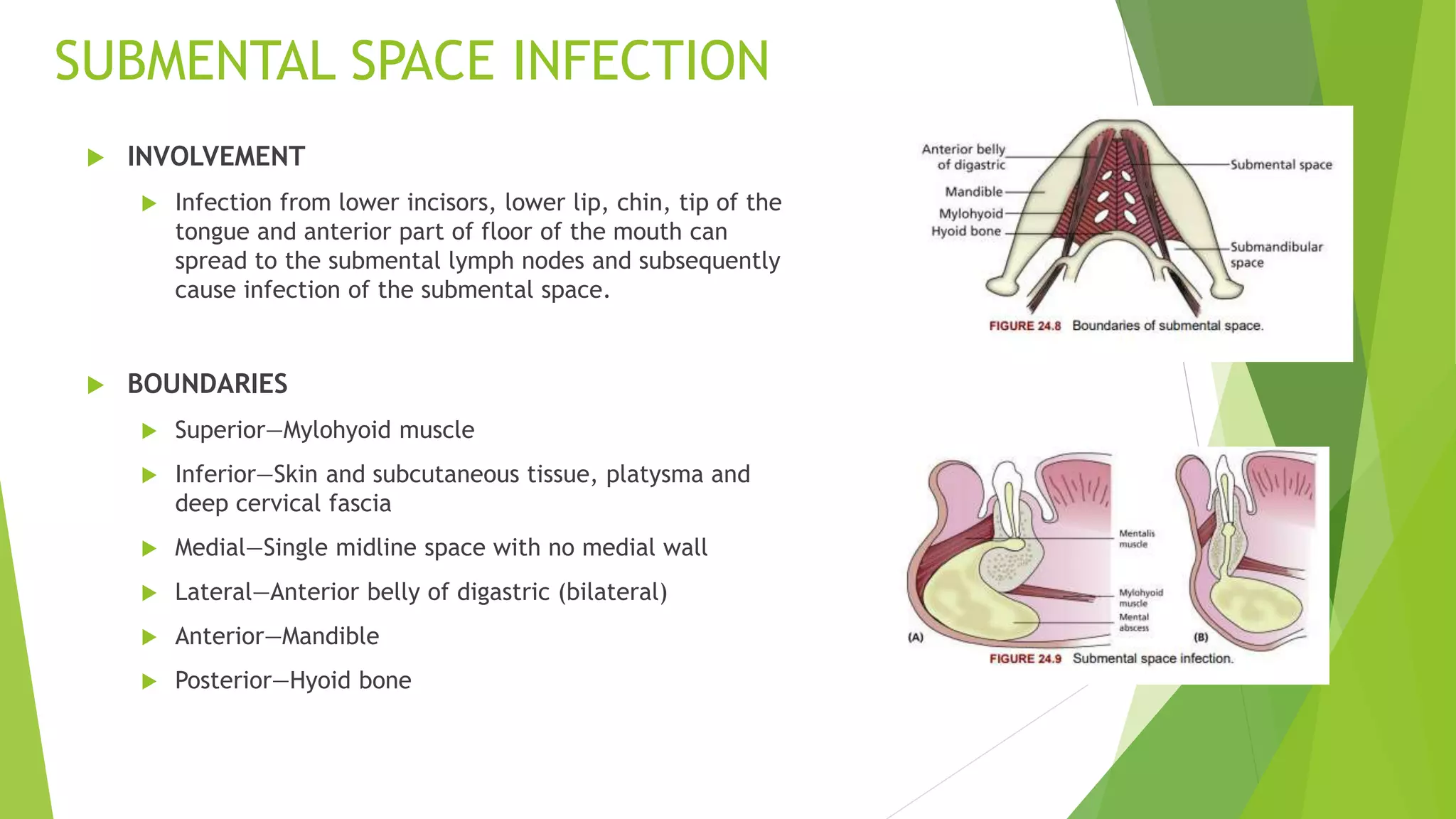 OMFS mandibular space infection.pptx
