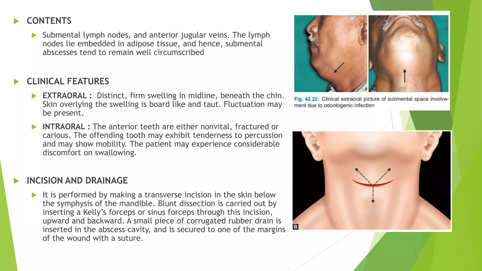 OMFS mandibular space infection.pptx