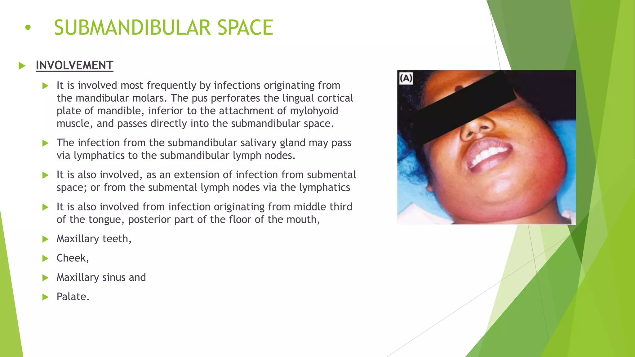 OMFS mandibular space infection.pptx