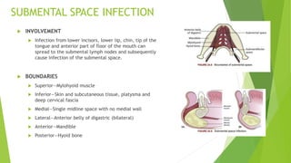 OMFS mandibular space infection.pptx