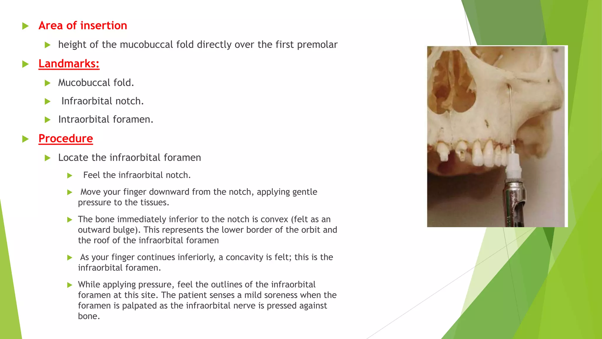 omfs maxillary inj tech.pptx