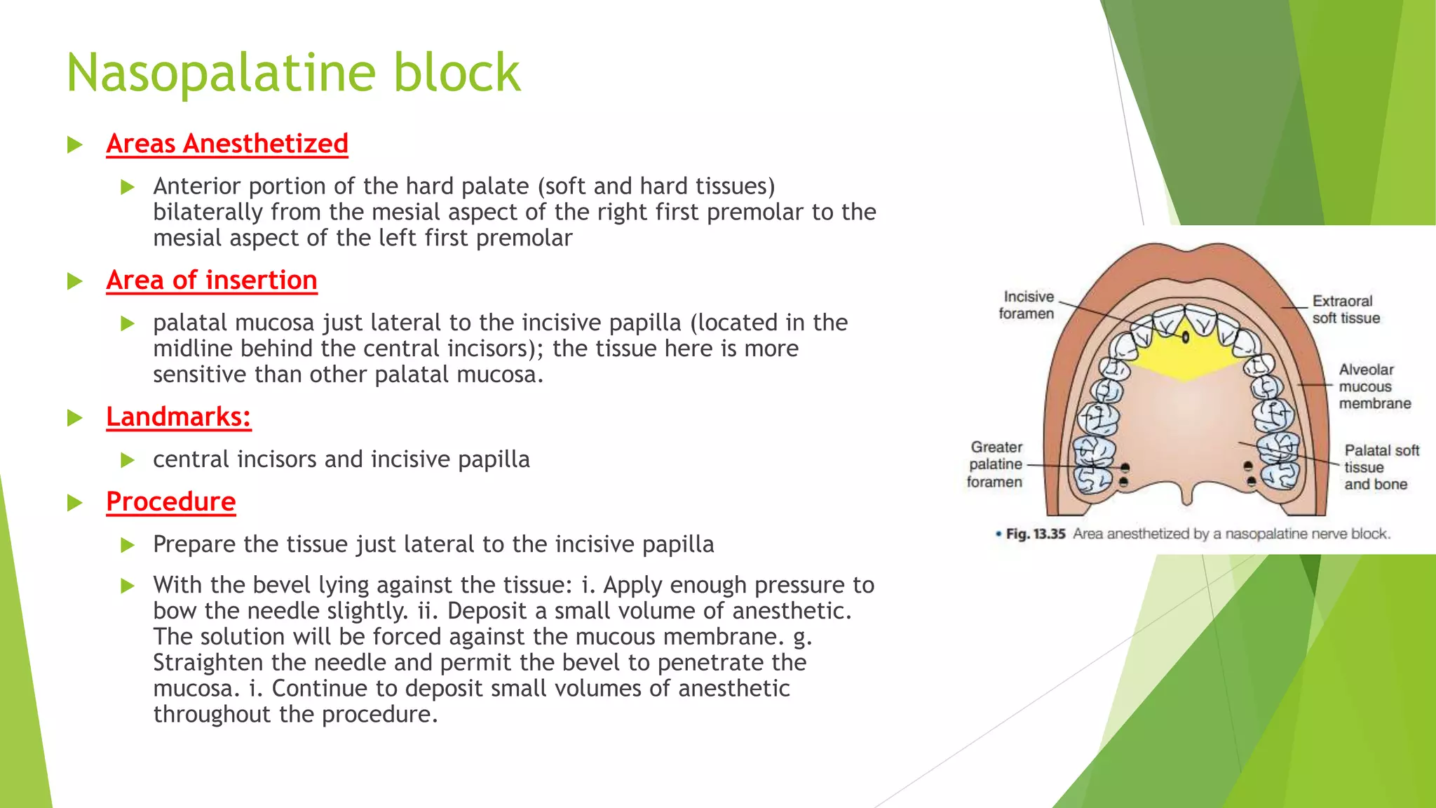 omfs maxillary inj tech.pptx